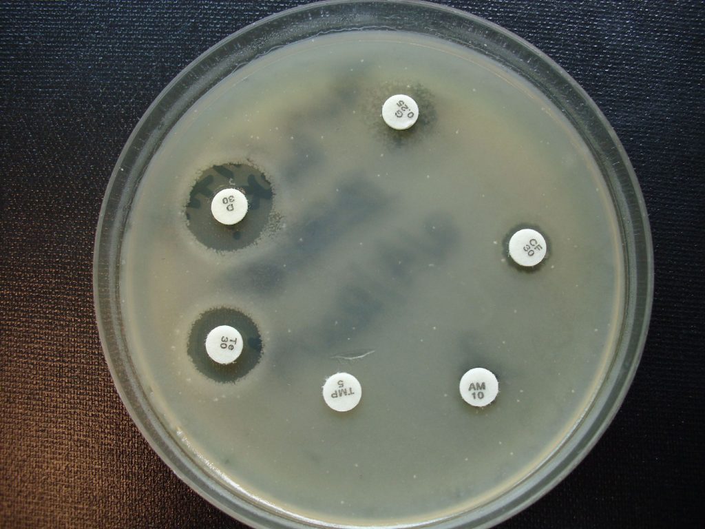 MIC Minimum Inhibitory Concentration Test Microbio Laboratory MIC Minimum Inhibitory Concentration Test Microbio Laboratory